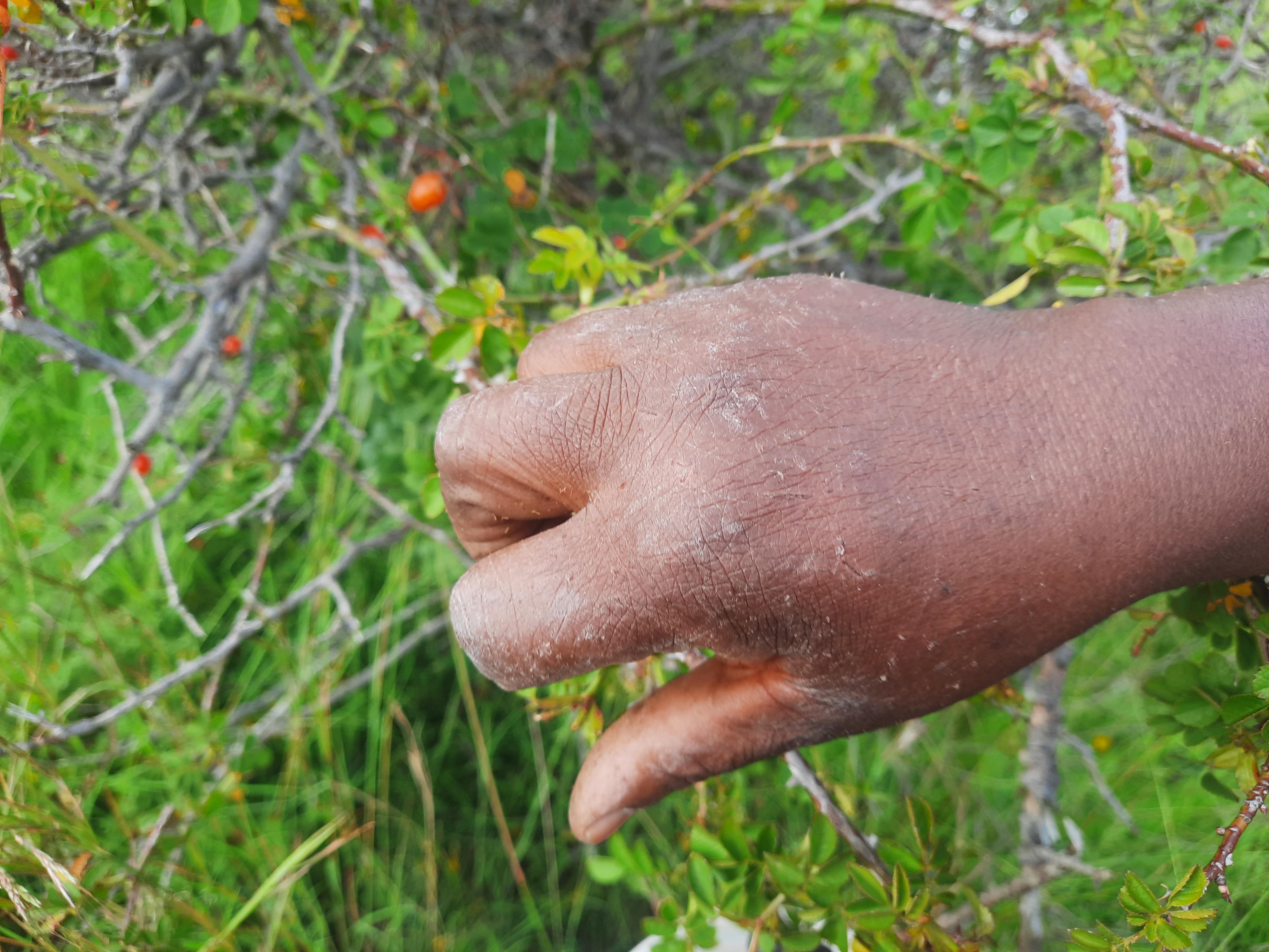 The thorny truth of Lesotho’s rosehip industry | GroundUp